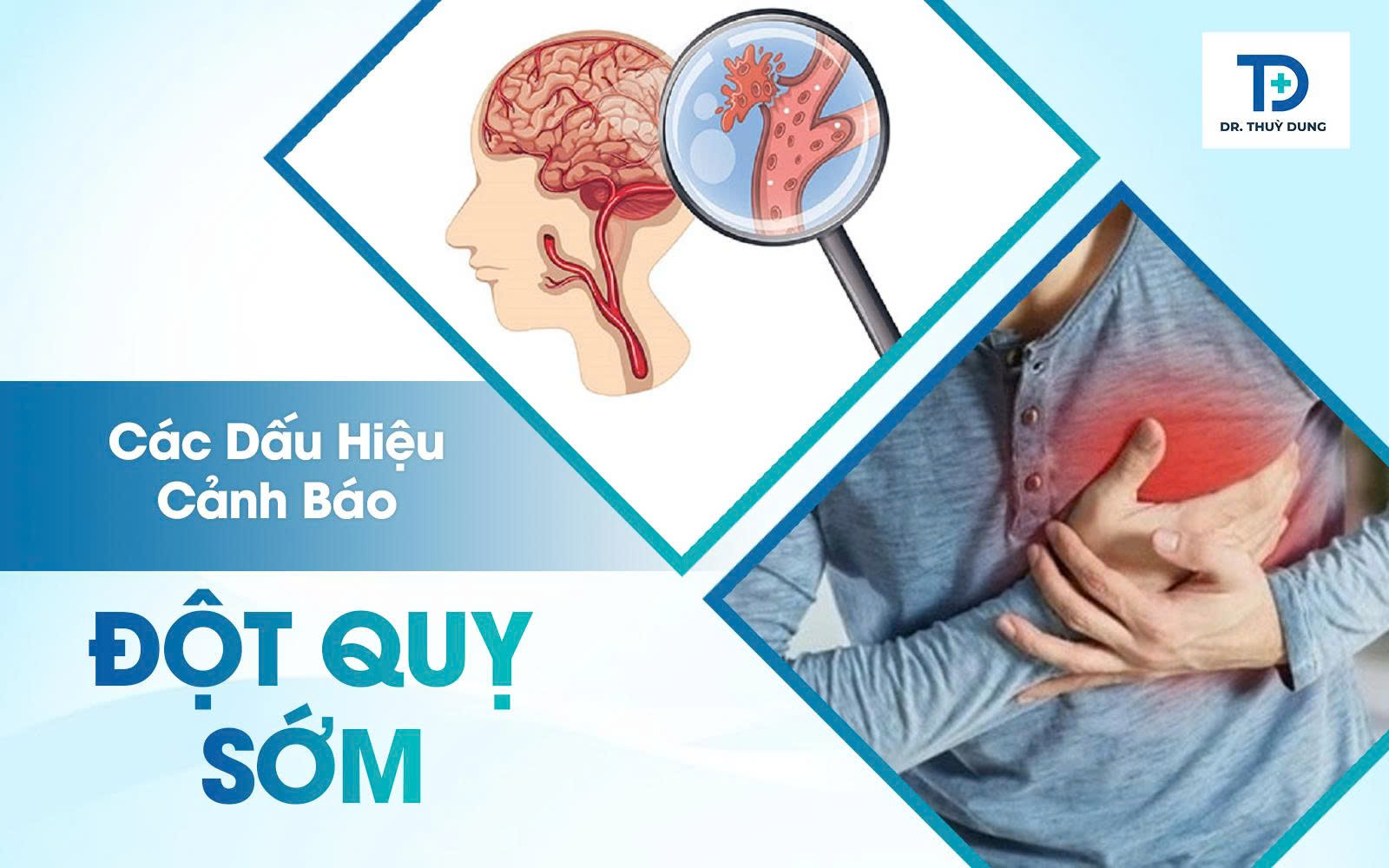Các Dấu Hiệu Cảnh Báo Đội Qụy Sớm - Dr Thùy Dung